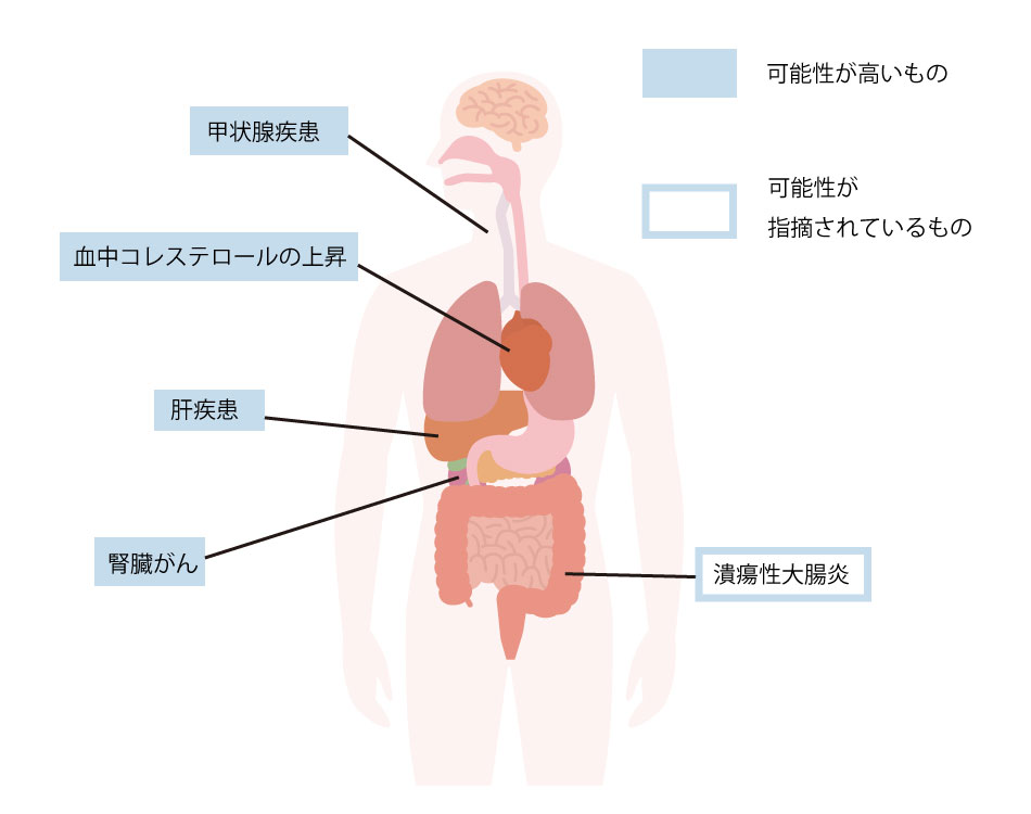 有機フッ素化合物PFAS（PFOS・PFOA）は浄水器で除去できる？検出された地域は？ | MIZSEI 水生活製作所